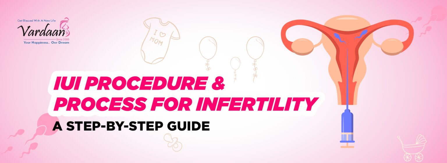 IUI Procedure & Process for Infertility: A Step-by-Step Guide