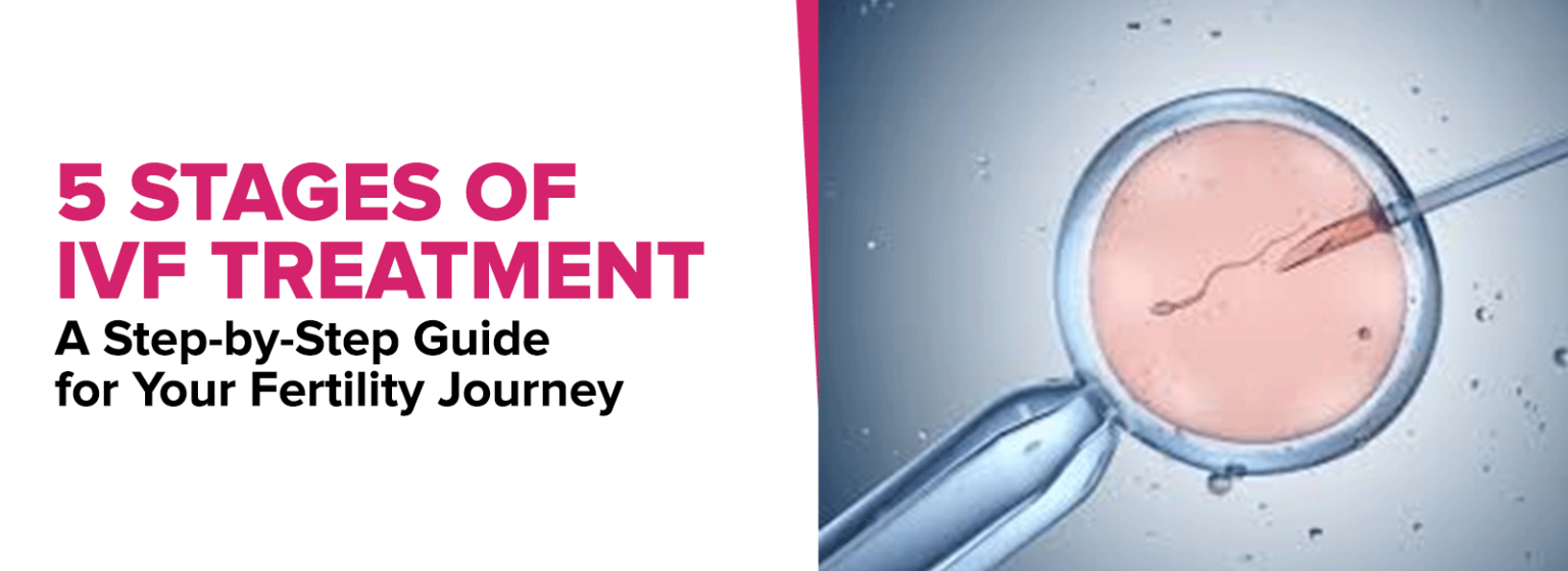 5 Stages of IVF Treatment: A Step-by-Step Guide for Your Fertility Journey