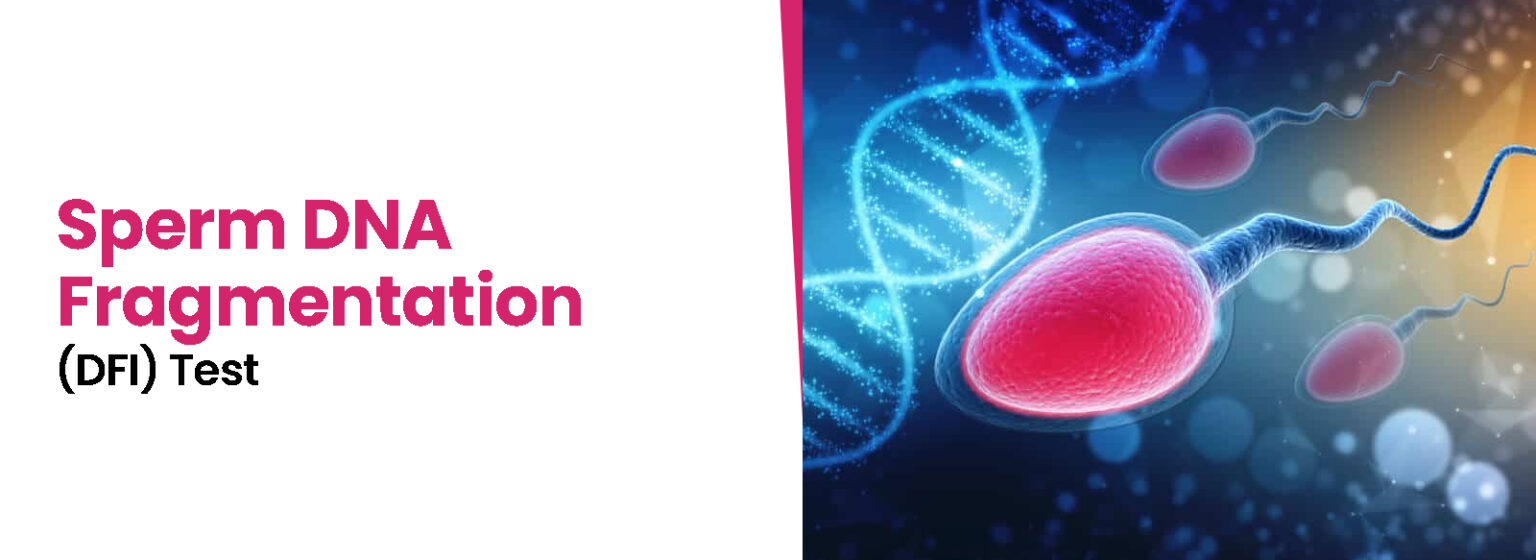 Sperm DNA Fragmentation (DFI) Test: Measurement of Male Fetility